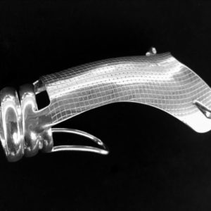 Silver Ring Splint Company | Medically Effective Hand and Finger Splints